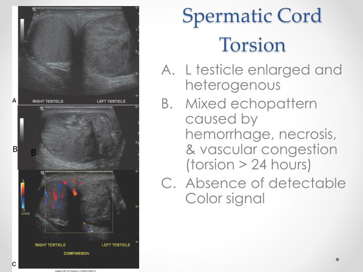 Ppt Scrotal Ultrasound Powerpoint Presentation Id 5671926