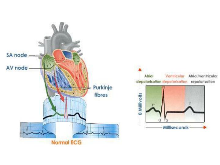 Ppt Neonate Heart Powerpoint Presentation Id6116693