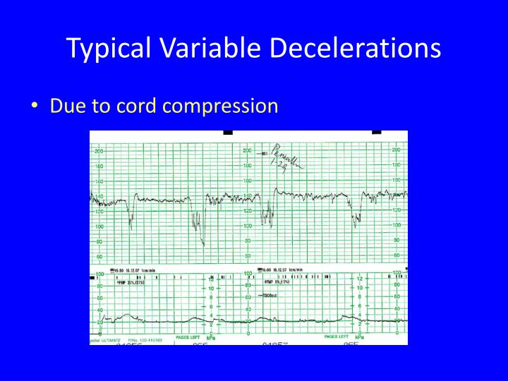 Ppt Ctg Interpretation And Management Powerpoint Presentation Id