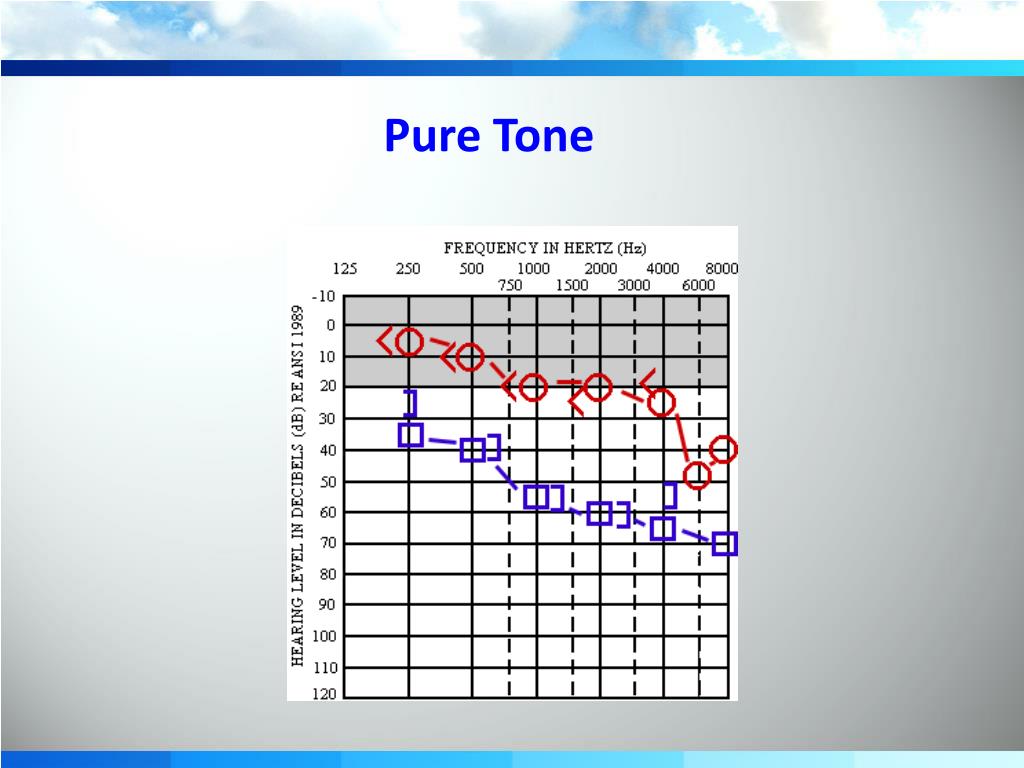 PPT - Acoustic Neuroma Department of Otorhinolaryngoglogy PowerPoint ...