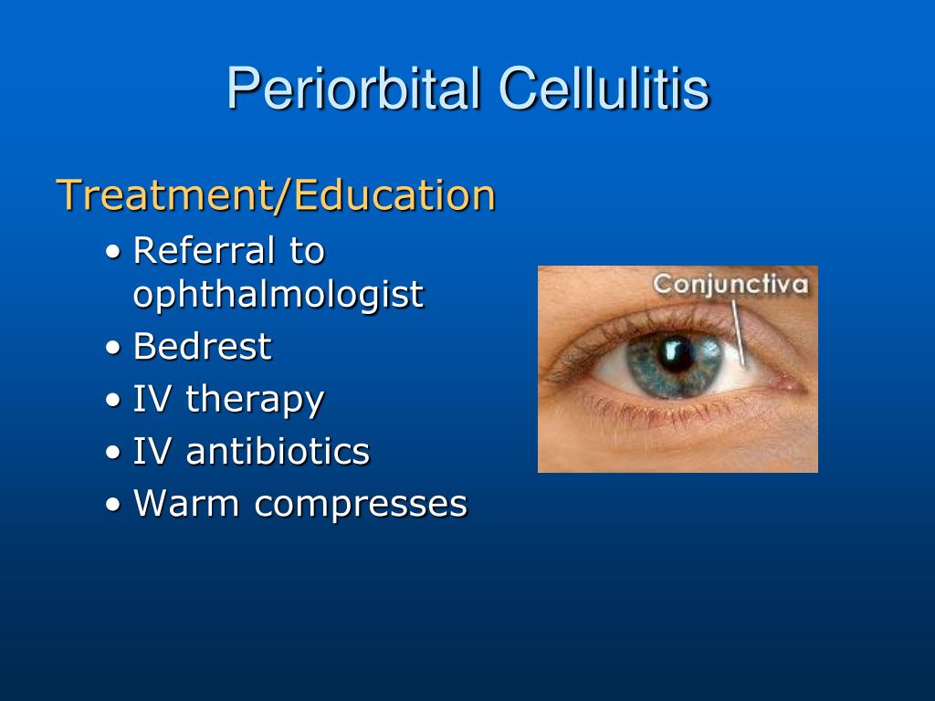 PPT Ocular Emergencies PowerPoint Presentation Free Download ID PPT Ocular Emergencies PowerPoint Presentation Free Download ID