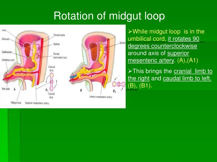 PPT - Development of Midgut loop: PowerPoint Presentation - ID:5381075