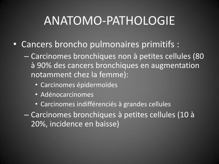 PPT - CANCER DU POUMON PowerPoint Presentation - ID:5382960