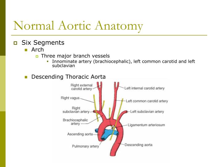 PPT - Diseases of the Great Vessels PowerPoint Presentation - ID:5387383