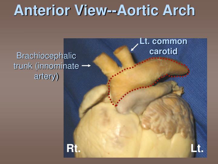 PPT - Sheep Heart Dissection 101 PowerPoint Presentation - ID:5388549