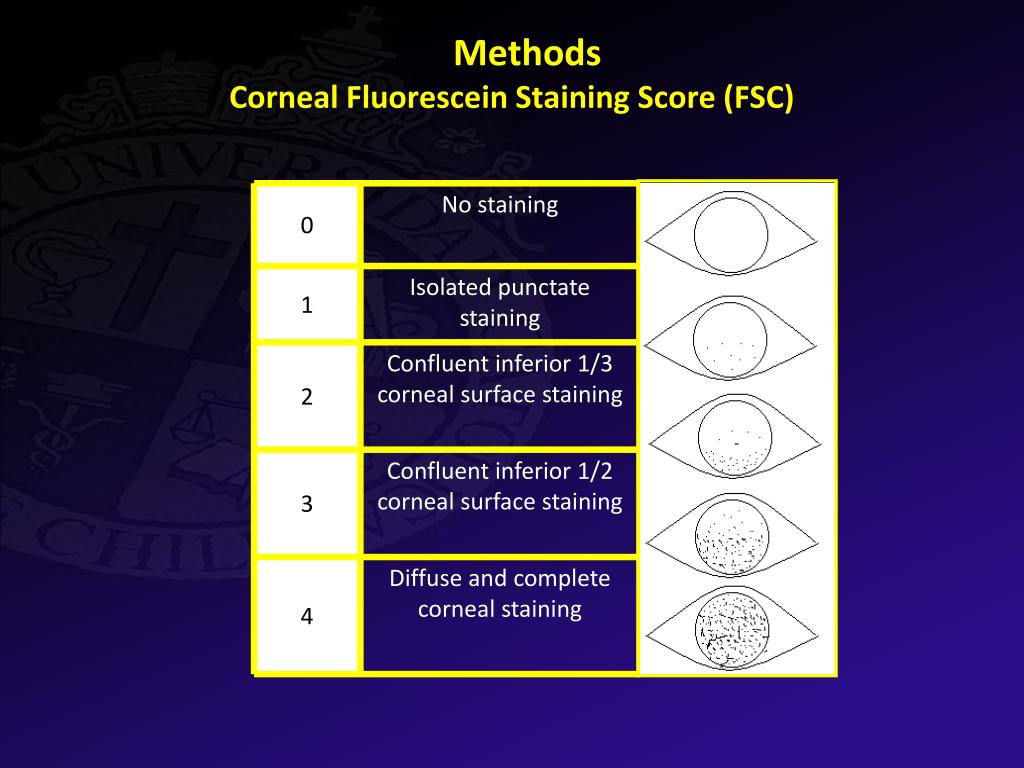 PPT - Autologous serum eye drops in severe post-LASIK dry eye ...