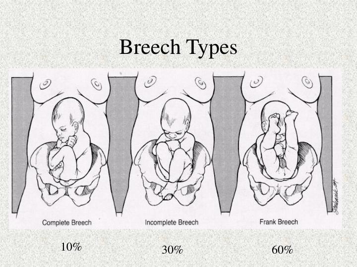 PPT - Oops She’s Delivering! PowerPoint Presentation - ID:5390975