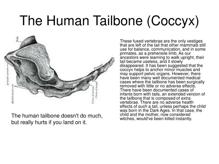 PPT - Top 10 Useless Limbs (and Other Vestigial Organs) PowerPoint ...