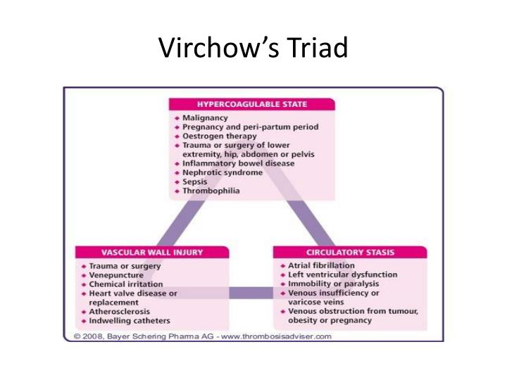 PPT - DEEP VEIN THROMBOSIS PowerPoint Presentation - ID:5393294