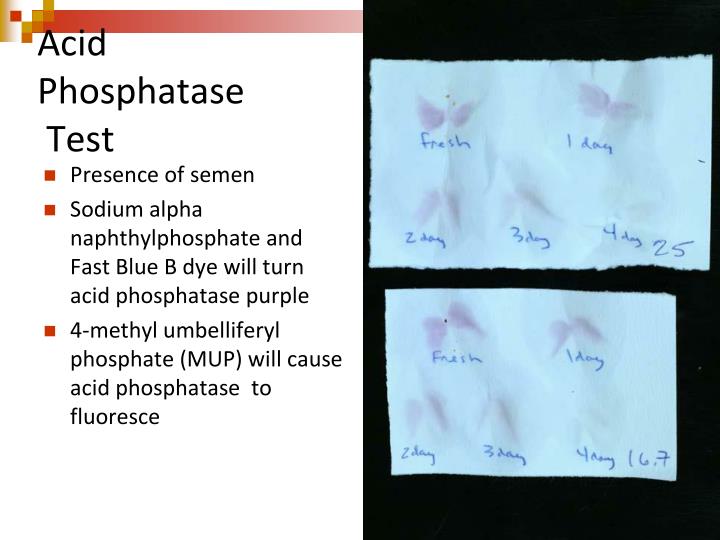 PPT - BLOODSTAIN PATTERNS PowerPoint Presentation - ID:5399501