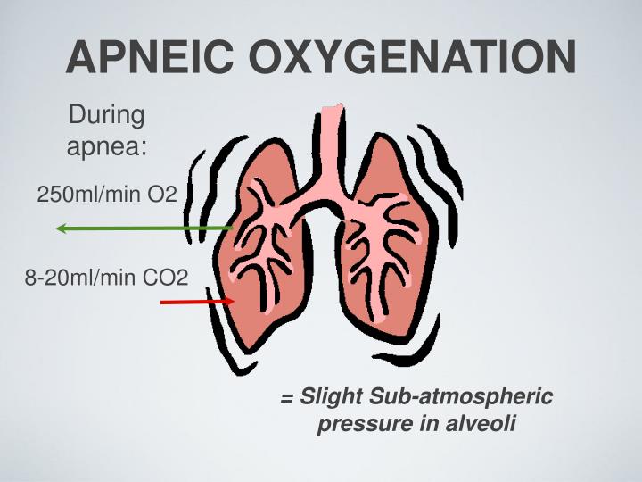 PPT - apneic oxygenation PowerPoint Presentation - ID:5406171