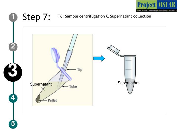 PPT - Extraction of protein from Cerebrospinal fluid PowerPoint ...