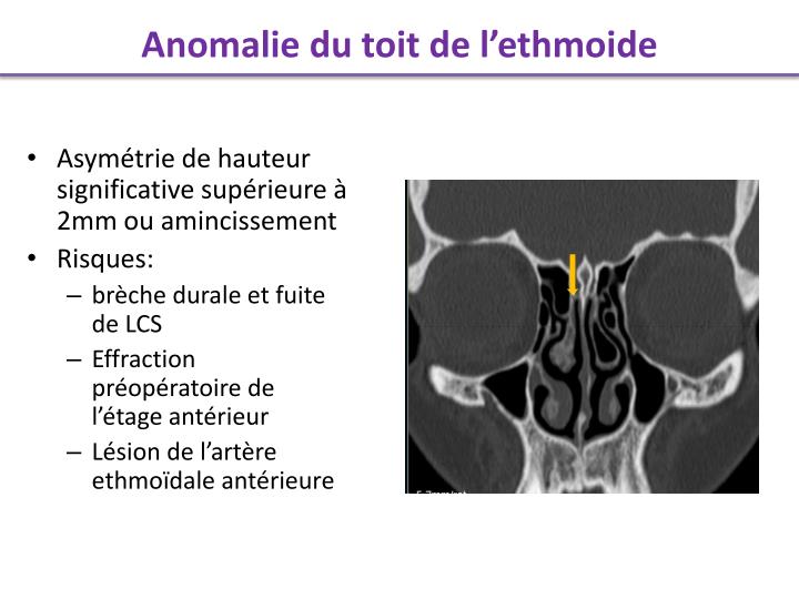PPT - HEAD AND NECK : HN 16 PowerPoint Presentation - ID:5409000