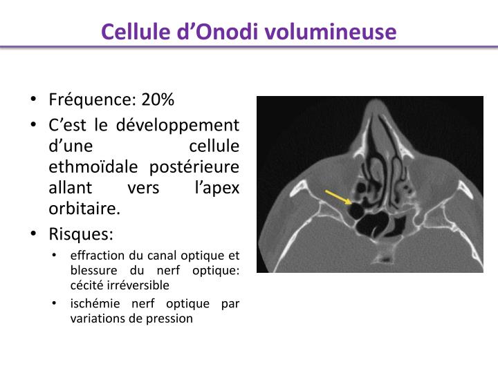 PPT - HEAD AND NECK : HN 16 PowerPoint Presentation - ID:5409000