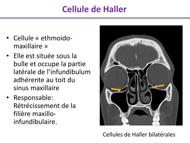 PPT - HEAD AND NECK : HN 16 PowerPoint Presentation - ID:5409000