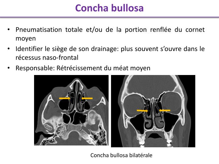 PPT - HEAD AND NECK : HN 16 PowerPoint Presentation - ID:5409000
