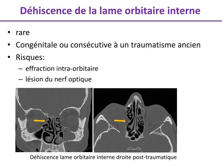 PPT - HEAD AND NECK : HN 16 PowerPoint Presentation - ID:5409000