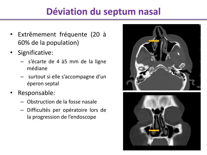 PPT - HEAD AND NECK : HN 16 PowerPoint Presentation - ID:5409000