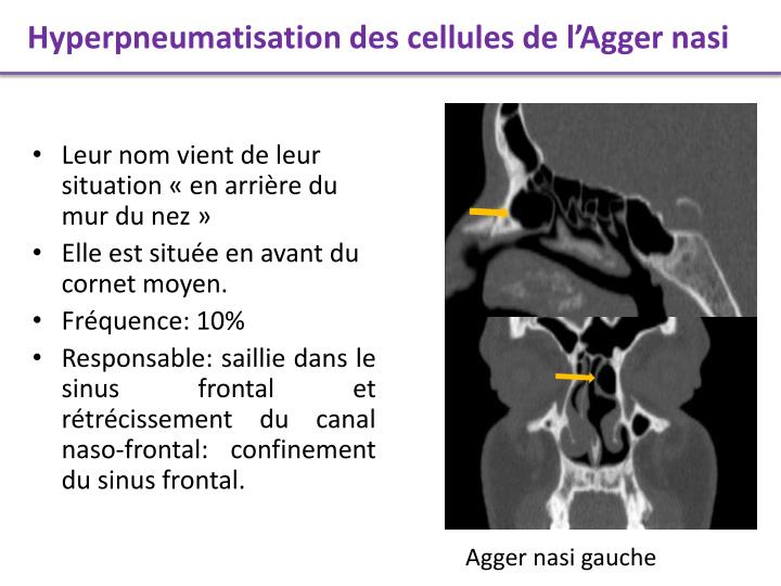 PPT - HEAD AND NECK : HN 16 PowerPoint Presentation - ID:5409000
