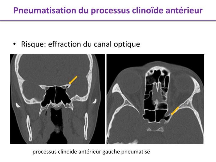 PPT - HEAD AND NECK : HN 16 PowerPoint Presentation - ID:5409000