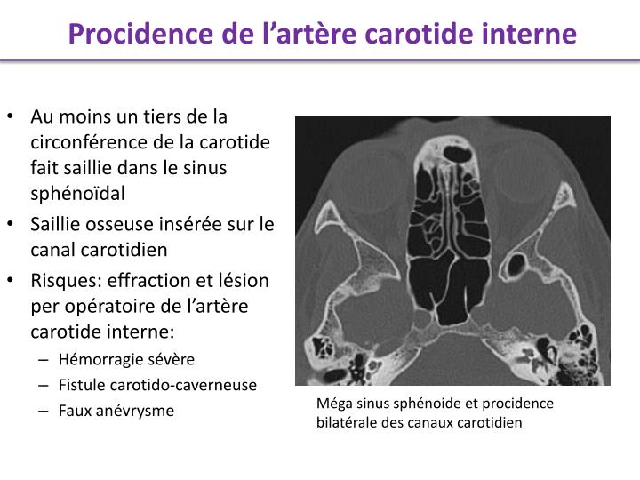 PPT - HEAD AND NECK : HN 16 PowerPoint Presentation - ID:5409000
