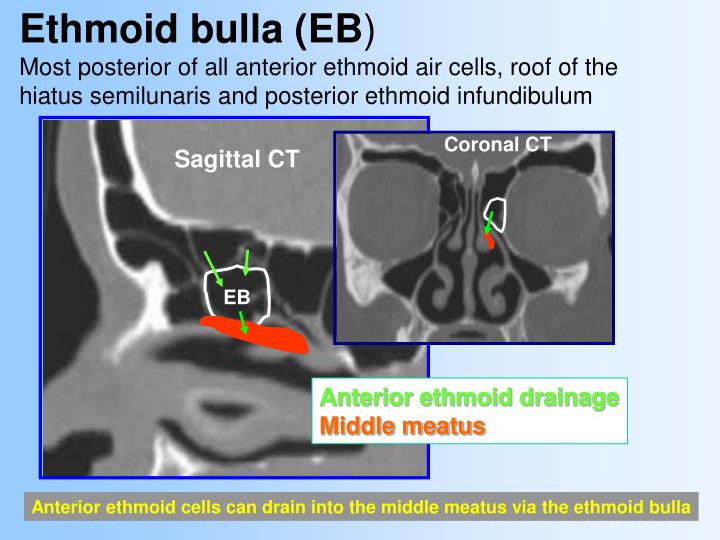 Ppt Anatomy And Relevant Anatomical Variants In Nasal And Paranasal