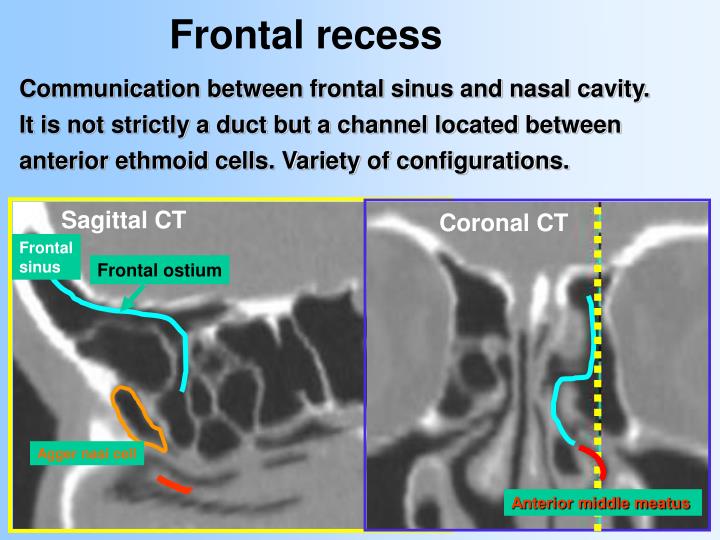 Ppt Anatomy And Relevant Anatomical Variants In Nasal And Paranasal