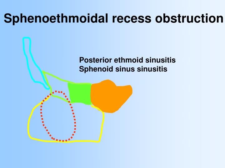 PPT - Anatomy and relevant anatomical variants in nasal and paranasal ...