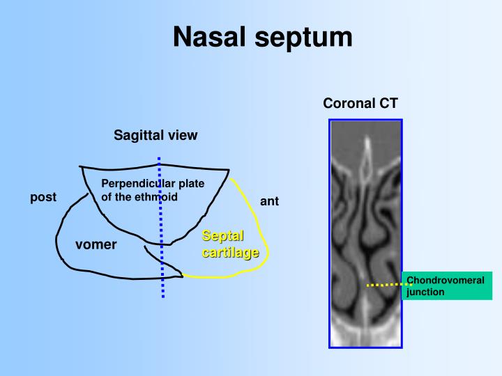 PPT - Anatomy and relevant anatomical variants in nasal and paranasal ...