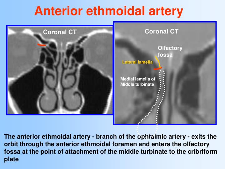 PPT - Anatomy and relevant anatomical variants in nasal and paranasal ...