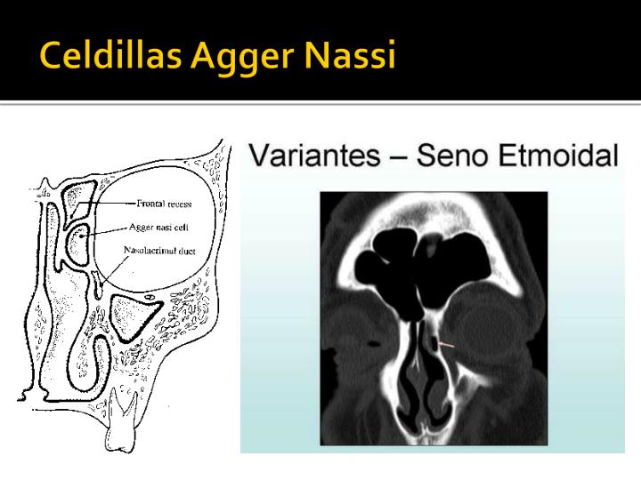 PPT - Repaso Cabeza y Cuello PowerPoint Presentation - ID:5409983