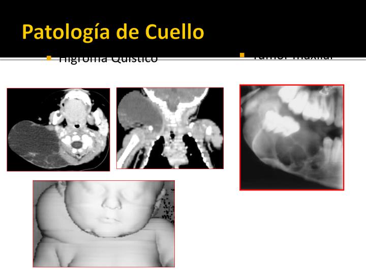 PPT - Repaso Cabeza y Cuello PowerPoint Presentation - ID:5409983