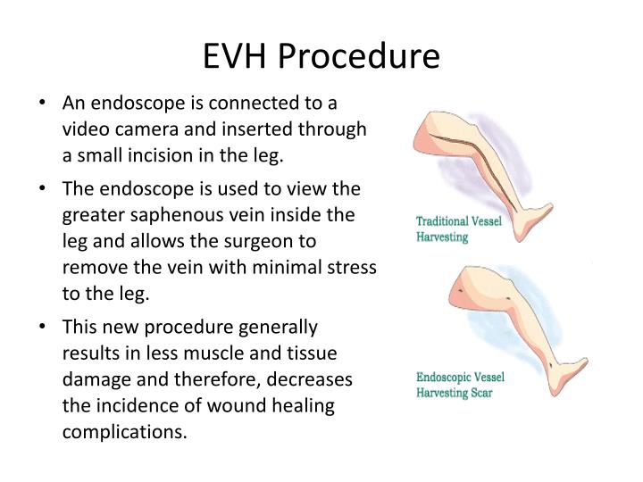 PPT - Endoscopy PowerPoint Presentation - ID:5410182