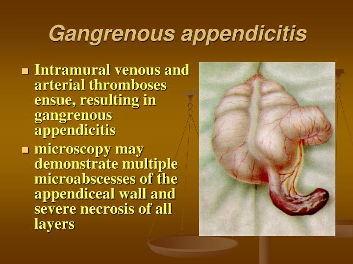 PPT - Purulent-inflammatory diseases of abdominal cavity Ass.Prof. Dr ...