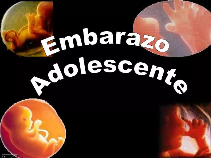 Ppt Embarazo En La Adolescencia Powerpoint Presentation Free Porn Sex