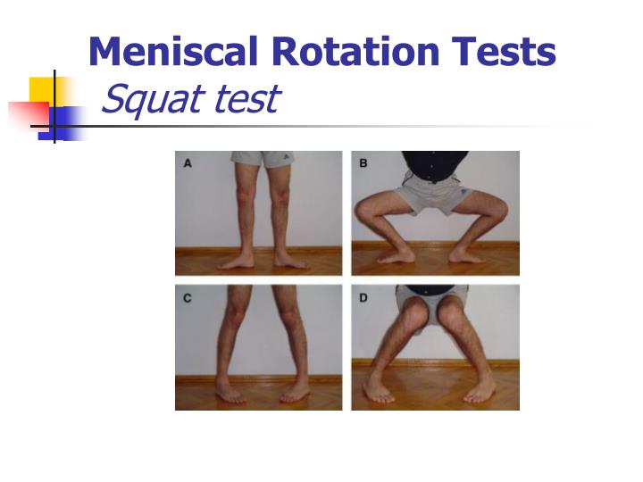 PPT - Clinical examination of the knee H.Mousavi Tadi,MD Department of ...