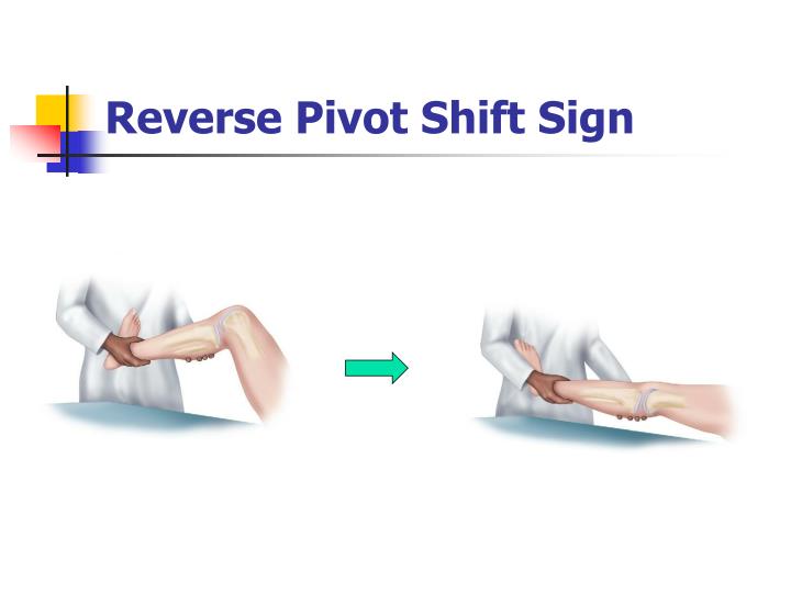 PPT - Clinical examination of the knee H.Mousavi Tadi,MD Department of ...