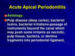 PPT - Acute apical periodontitis (parodontitis apicalis acuta ...