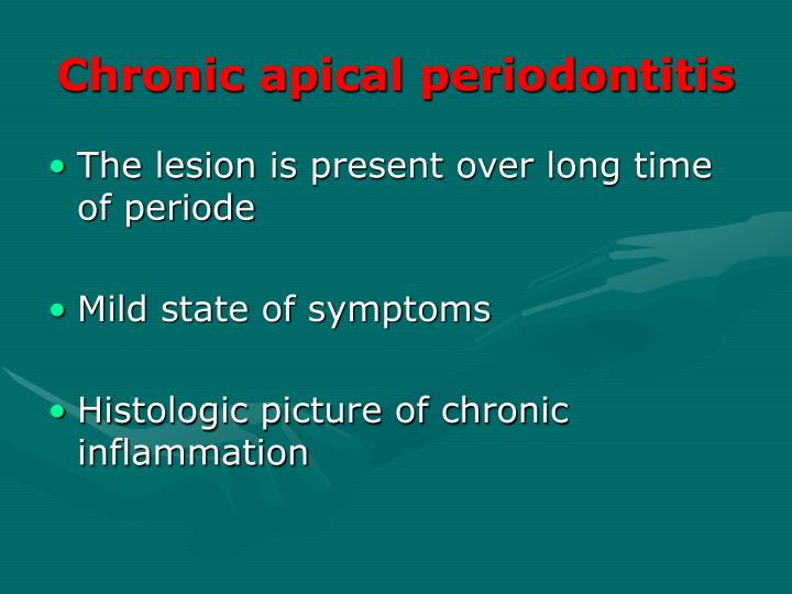 Chronic Apical Periodontitis Single Visit Rct And Post/core Placement
