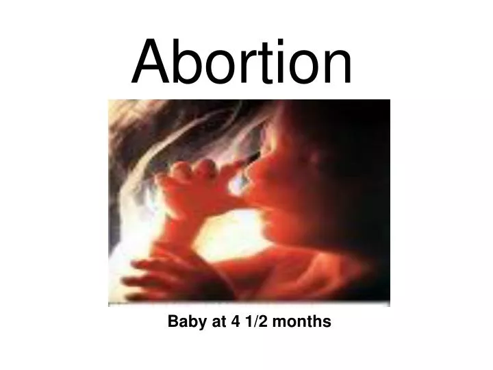 PPT - Abortion PowerPoint Presentation, free download - ID:5429103