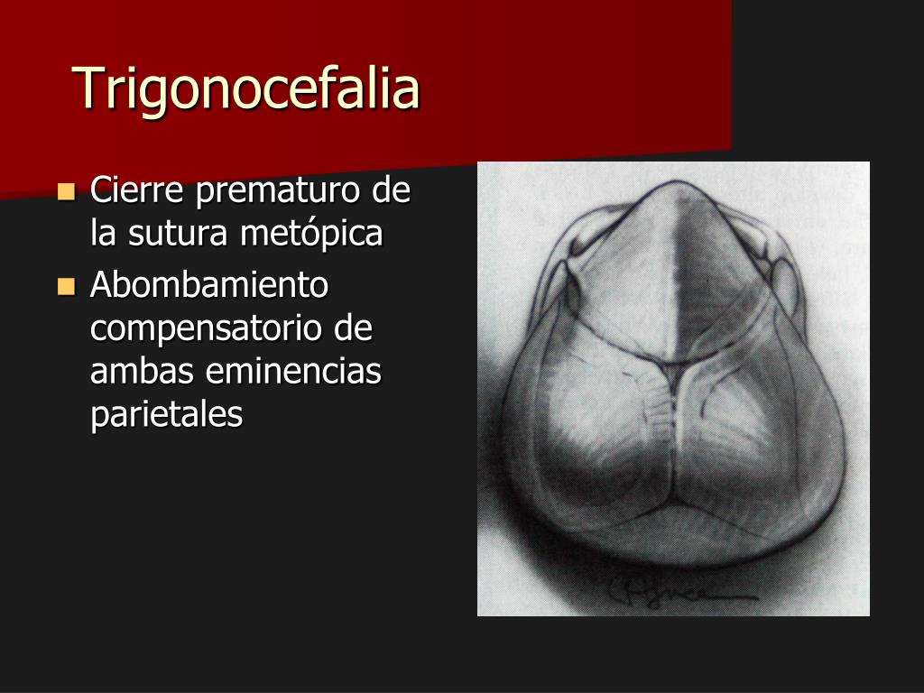 PPT - Semiología del Cráneo Dr. Alejandro Cáceres Bassaletti Jefe de ...