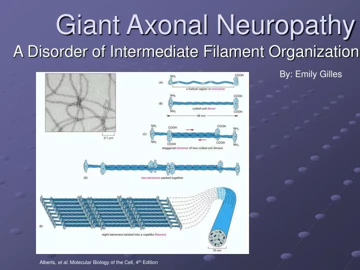 PPT - Giant Axonal Neuropathy PowerPoint Presentation, free download ...