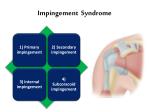 PPT - Impingement Syndrome PowerPoint Presentation - ID:5436216