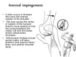 PPT - Impingement Syndrome PowerPoint Presentation - ID:5436216