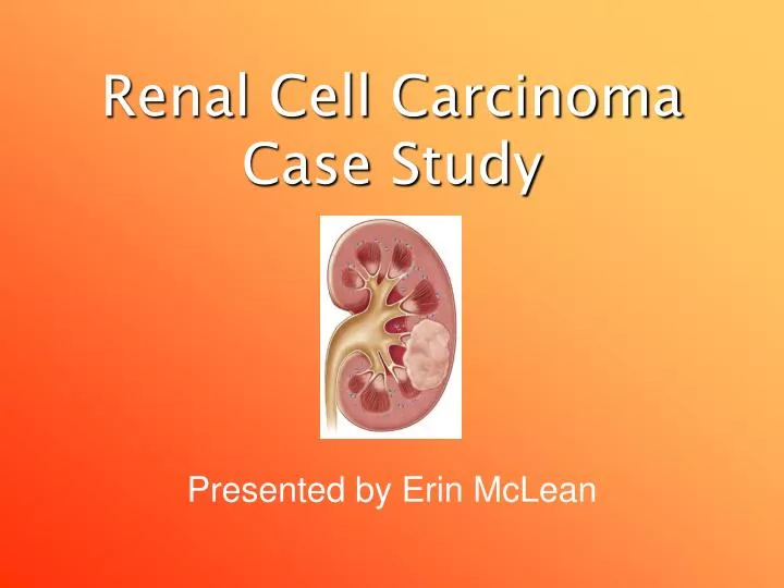 PPT - Renal Cell Carcinoma Case Study PowerPoint Presentation, free ...