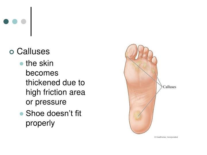 PPT - Basic Tissue Injuries PowerPoint Presentation - ID:5437750