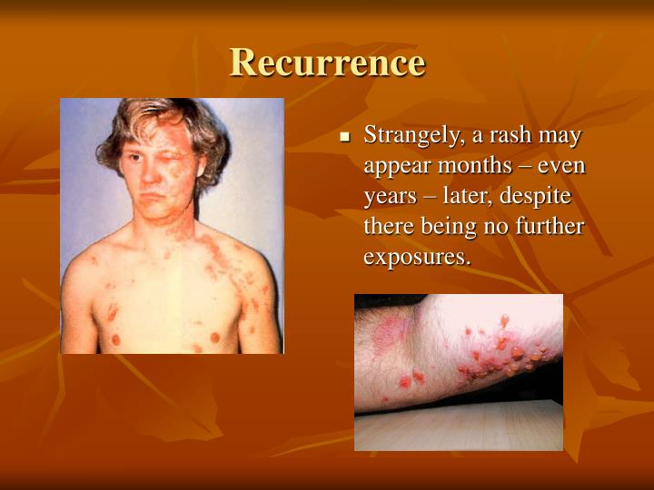 PPT - Urushiol PowerPoint Presentation - ID:5439810