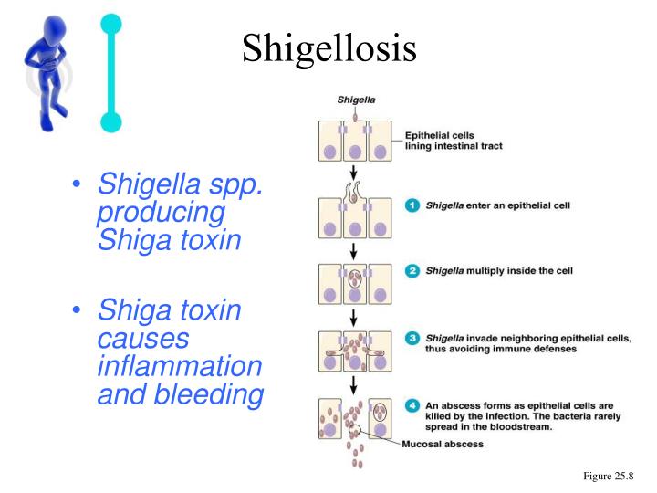 PPT - G astrointestinal T ract I nfections PowerPoint Presentation - ID ...