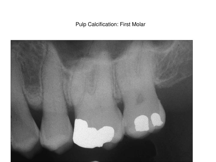 PPT - RADIOGRAPHIC INTERPRETATION OF PULPAL AND PERIAPICAL DISEASE ...