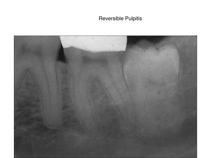 PPT - RADIOGRAPHIC INTERPRETATION OF PULPAL AND PERIAPICAL DISEASE ...